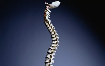 Spinal Cord Injuries
